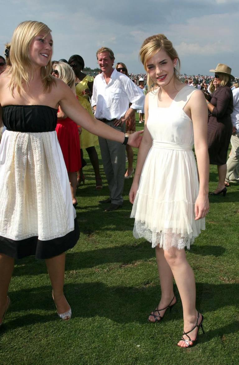 FOTO Emma Watson prima e dopo: come era?